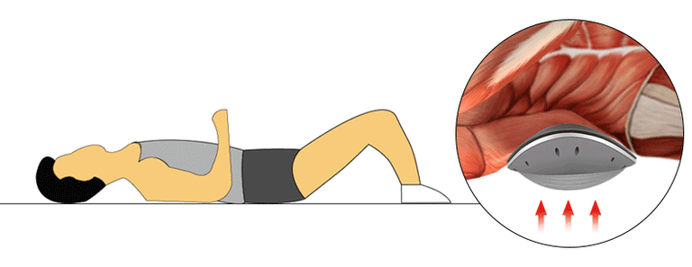 Siyaco Multifunctional Lumbar Traction Device: Back Pain Relief